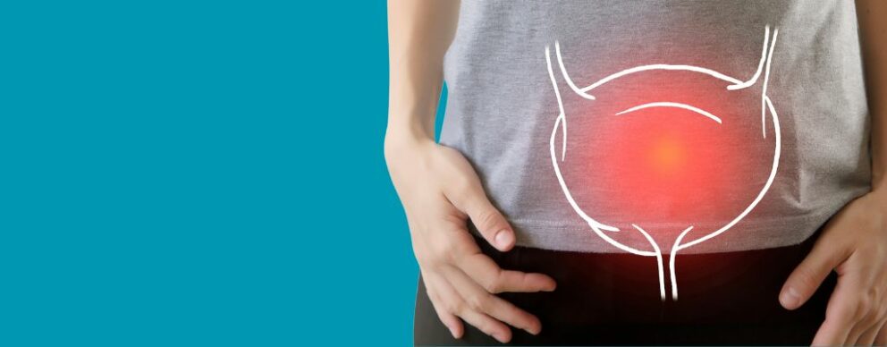 Treating Radiation Cystitis with Hyperbaric Oxygen