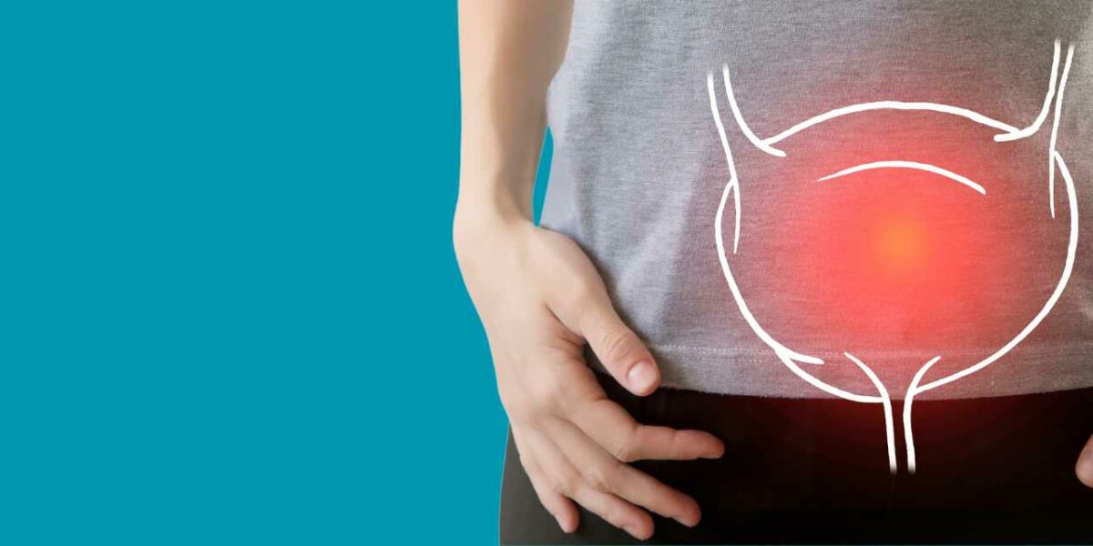 Treating Radiation Cystitis with Hyperbaric Oxygen